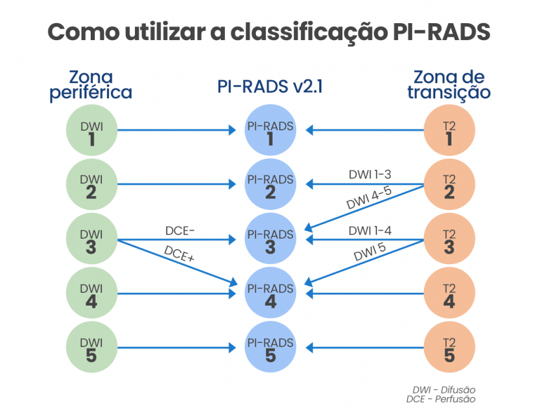PI-RADS: como usar classificação para câncer de próstata - Educa Cetrus