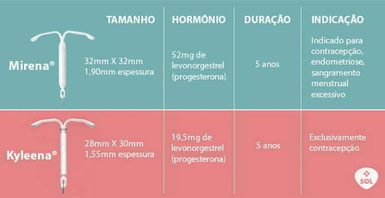 DIU: Guia completo sobre tipos, inserção, retirada e vantagens